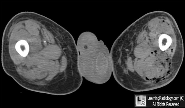 LearningRadiology