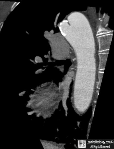 Learning Radiology - Archives 2017