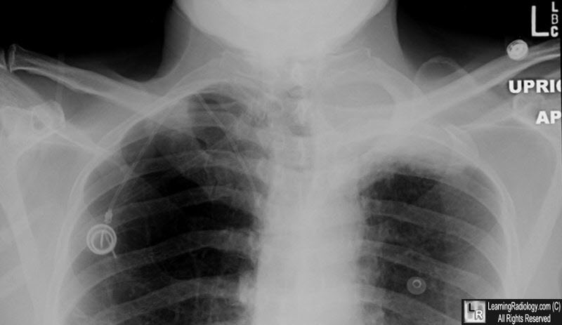 Learning Radiology - Archives 2017