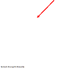 LearningRadiology - Diseases of the Great Vessels