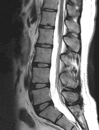 Back Pain Imaging
