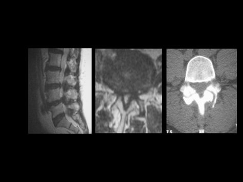 Back Pain Imaging