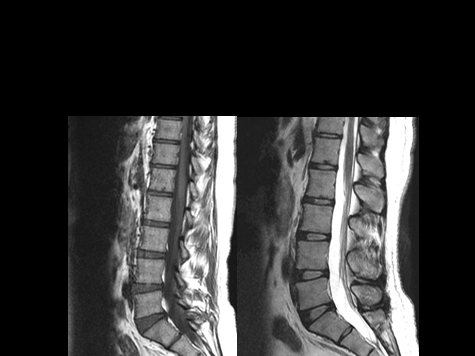 Back Pain Imaging