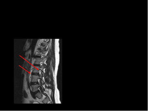 Back Pain Imaging