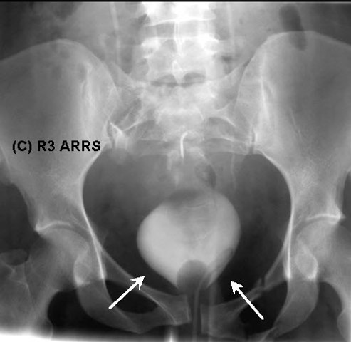 Welcome to LearningRadiology - radiology, radiologic, imaging, sign ...